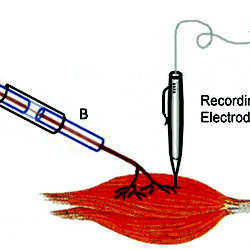 Electrophysiological test.