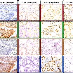 Representative examples of immunohistochemistry staining for the four ...