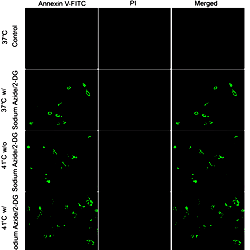 Apoptosis was detected with Annexin V-FITC and PI staining.