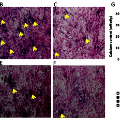 VSMC calcification.