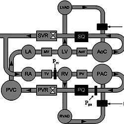 Schematic of the MCL setup with biventricular support.