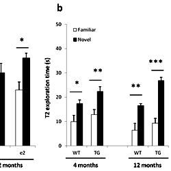 Object Recognition Test (ORT).