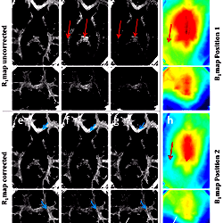 Transverse and coronal slices of: (a) Uncorrected R1 maps using ...
