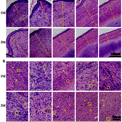 H&E staining of sections of scar hyperplasia at 1, and 3 months after ...