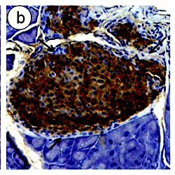 Beta cell immunohistochemistry.