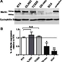 Quantification of Merlin expression in cerebellar tissue, cell lines ...
