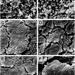 Scanning electron micrographs of untreated and air plasma treated biofilms on polycarbonate discs.