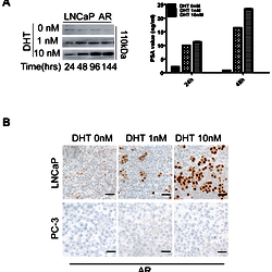 DHT upregulates AR expression and increases PSA secretion in LNCaP cells.