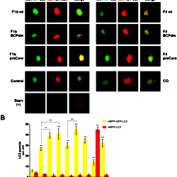 Expression of the tandem protein mRFP-GFP-LC3 in cells transfected with full-length HBV genomes.