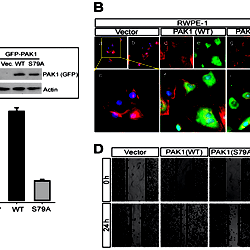 S79A mutation abolishes the migration activity of PAK1.