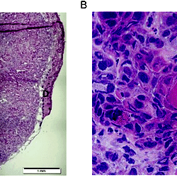 Histological characterization of human A431 subcutaneous tumors in nude ...