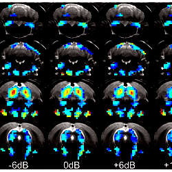 BOLD signal maps at different ILDs.