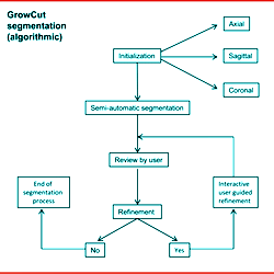 Workflow: The phases of the user guided GrowCut segmentation process is ...