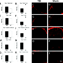 GFAP staining.