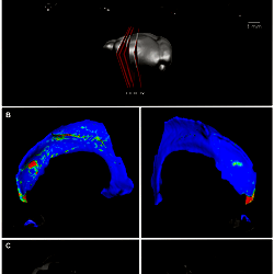 3D OPT imaging of DCX staining in the mouse brain.