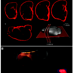 3D OPT imaging of GFAP staining in the mouse brain.