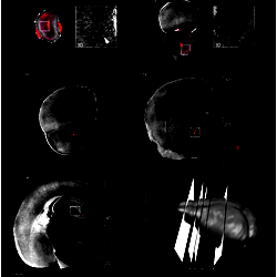 3D serial two-photon tomography imaging of DCX staining in the mouse brain.