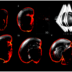 3D serial two-photon tomography imaging of GFAP staining in the mouse ...