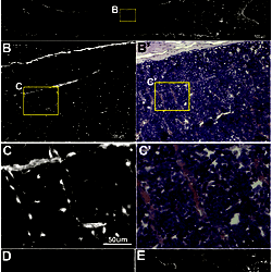 Visualization of OEC Mediated Cre Reporter Expression Inside the Bone ...