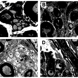 Unmyelinated axons in Remak bundles.
