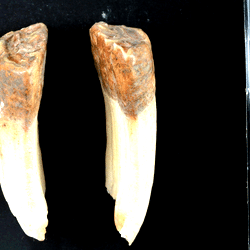 Photograph of mesial/anterior face of both left and right LPM2 teeth ...