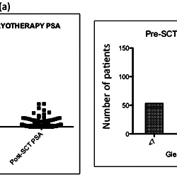 PSA and Gleason sum scores of SCT population.