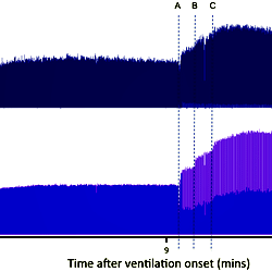 Expired CO2 levels and tidal volumes measured in a newborn lamb during ...