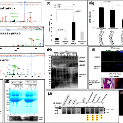 Phosphorylation analysis of posterior longitudinal ligament ...