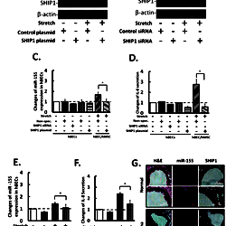 The role of SHIP1 in hBEC signaling and inflammation.