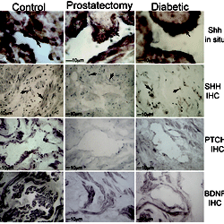 In situ for Shh RNA and IHC for SHH protein, were performed on corpora ...