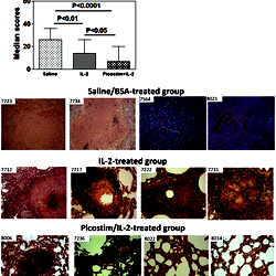 Picostim/IL2-treated group showed immune resistance to TB lesions in ...