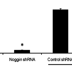 Expressional noggin gene in ASCs transduced with noggin shRNA ...