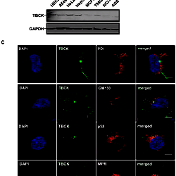 Characterization of TBCK.
