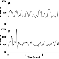 Examples of one minute EEG recordings from two fetuses.