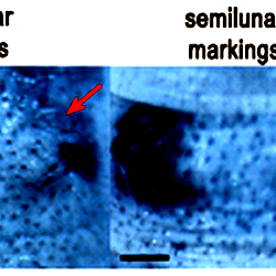 The phenotype of discolored markings (eye-shaped markings, semilunar ...
