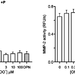 Effect of MMP-2 phosphorylation status in regard to activity changes ...