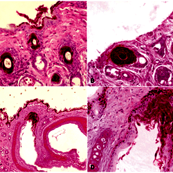 Skin of the muzzle of a Geomyces destructans infected Myotis ...
