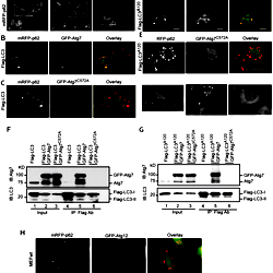 p62 aggregates sequester Atg7 in a LC3-dependent manner.