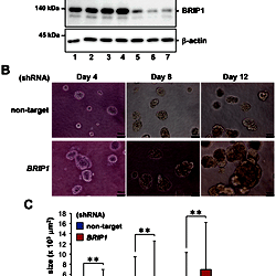 BRIP1 knockdown in mammary epithelial cells impairs acinus formation.