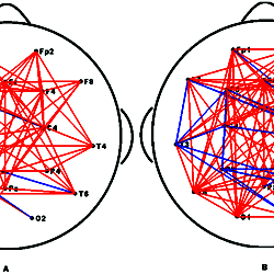 Nodal connection differences of networks of the subject from Group 1 ...