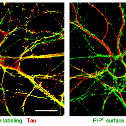PrPC co-immunolabeling with Tau and MAP2.