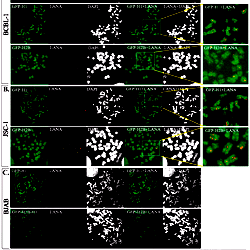 Localization of GFP-fused histone H1 and H2B with LANA in PEL cells.