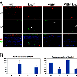 Expression of PLVAP and claudin-5 in WT, Lrp5-/-, Vldlr-/- and DKO retinas.