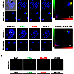 Micronemal localization of PfMA in merozoites analyzed by confocal and ...
