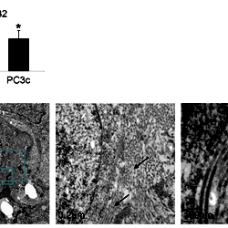PC3c cells highly expressed type I collagen.