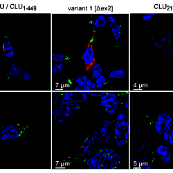 Subcellular localization of individual CLU isoforms.