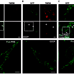 Investigation of the mitochondrial morphology following the addition of ...