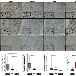 The distribution of cell cycle phase markers in the first cohort and ...