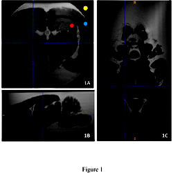 Regions of interest and 3D MRI acquisition.