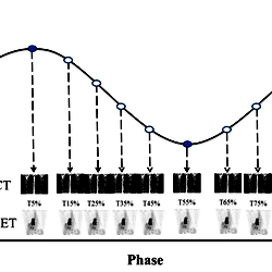 4D-CT and 4D-PET imaging.